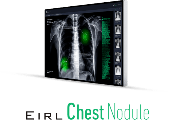 EIRL(エイル) | AI画像診断支援技術 | エルピクセル株式会社 - EIRL（エイル）は、CT, MRI, 病理画像などの医療画像を中心に多様な医療ビックデータを活用し、独自の人工知能 ...
