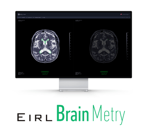 EIRL(エイル) | AI画像診断支援技術 | エルピクセル株式会社 - EIRL（エイル）は、CT, MRI, 病理画像などの医療画像を中心に多様な医療ビックデータを活用し、独自の人工知能 ...
