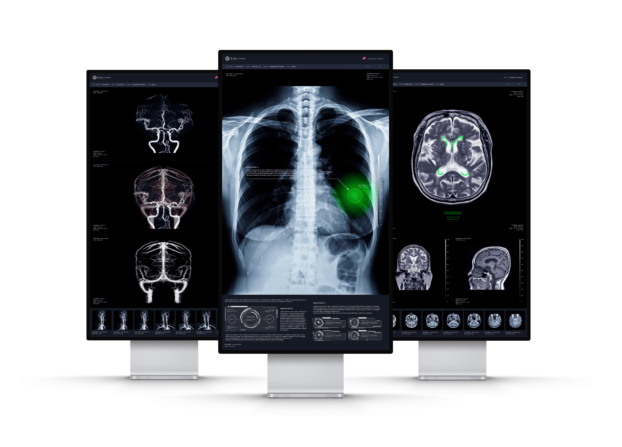 EIRL(エイル) | AI画像診断支援技術 | エルピクセル株式会社 - EIRL（エイル）は、CT, MRI, 病理画像などの医療画像を中心に多様な医療ビックデータを活用し、独自の人工知能 ...