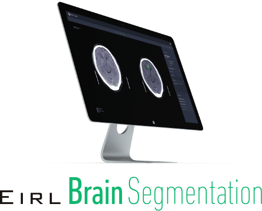 EIRL | PRODUCED BY LPIXEL | LPIXEL Inc. - Another set of powerful eyes ...