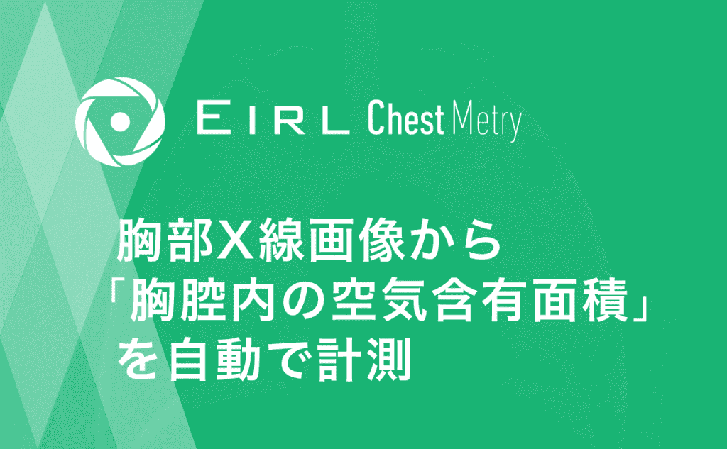 J-MID - EIRL(エイル) | AI画像診断支援技術 | エルピクセル株式会社