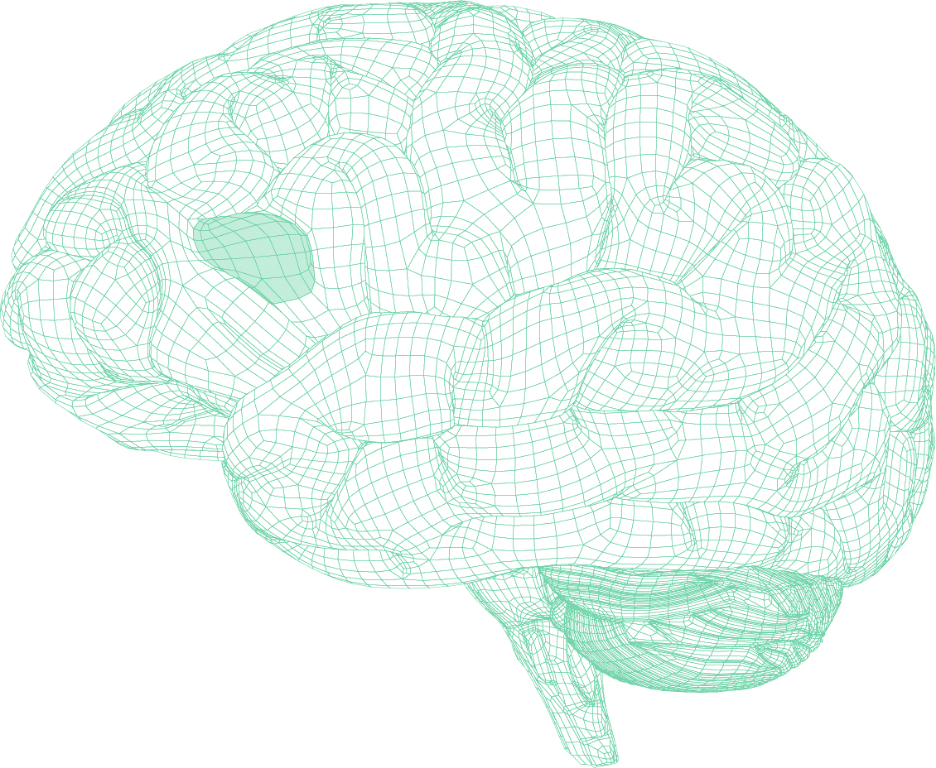 EIRL Brain Segmentation - EIRL | NEXT MEDICAL VISION | LPIXEL Inc.