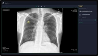EIRL Cloud(エイル クラウド) - EIRL(エイル) | AI画像診断支援技術 | エルピクセル株式会社