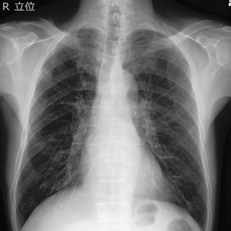 EIRL Cloud(エイル クラウド) - EIRL(エイル) | AI画像診断支援技術 | エルピクセル株式会社