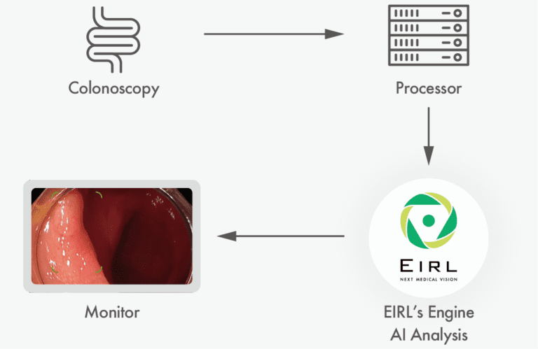 EIRL Colon Polyp - EIRL(エイル) | AI画像診断支援技術 | エルピクセル株式会社