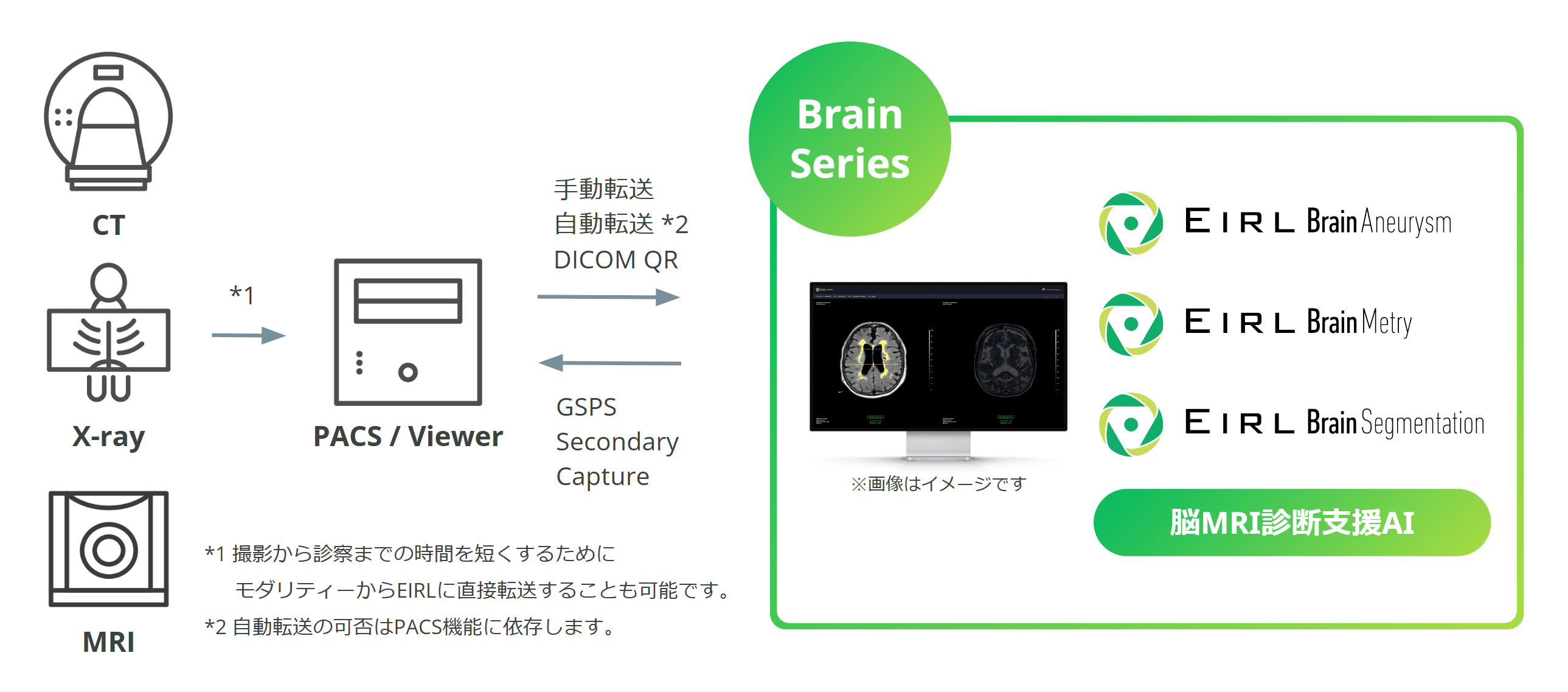 Nttデータが開発した脳mri診断支援ai技術を エルピクセルが「eirl Ai パートナープログラム」で製品化 ~パートナー各社との連携に