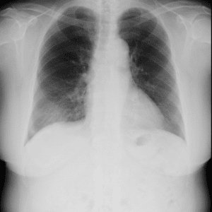 EIRL Cloud(エイル クラウド) - EIRL(エイル) | AI画像診断支援技術 | エルピクセル株式会社